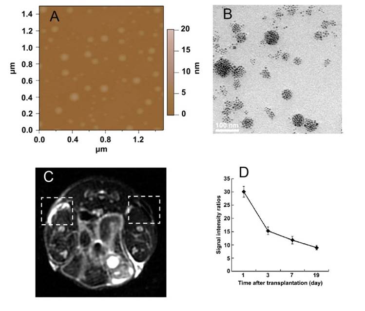 Superparamagnetic Iron Oxide Nanoparticles as MRI contrast agents for ...