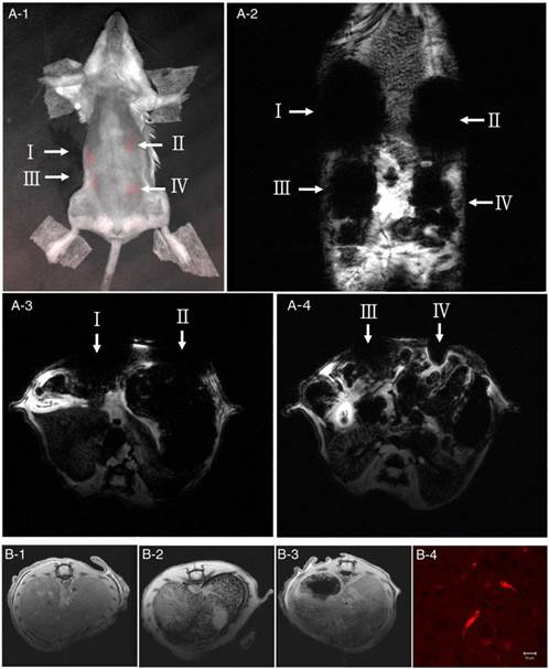 Superparamagnetic Iron Oxide Nanoparticles as MRI contrast agents for ...