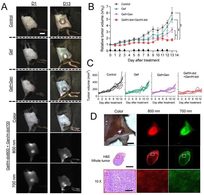 Image-guided drug delivery of nanotheranostics for targeted lung cancer ...