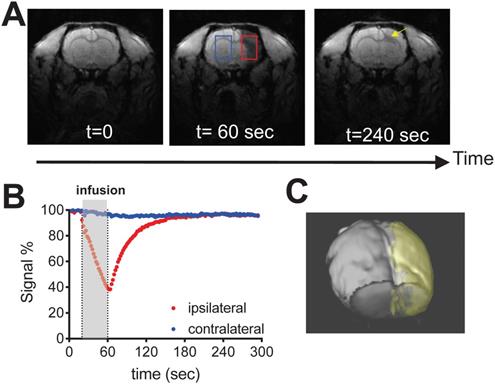 Deuterium oxide as a contrast medium for real-time MRI-guided ...