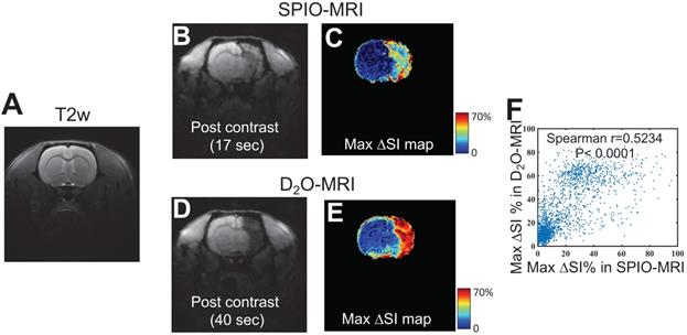 Deuterium oxide as a contrast medium for real-time MRI-guided ...