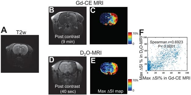 Deuterium oxide as a contrast medium for real-time MRI-guided ...