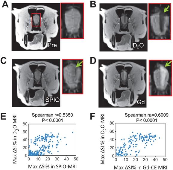 Deuterium oxide as a contrast medium for real-time MRI-guided ...
